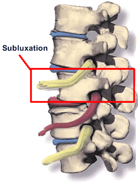 vertebral_subluxation – CORE Chiropractic