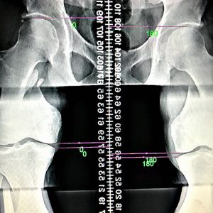 X-Rays at CORE Chiropractic - Do You Need Them?